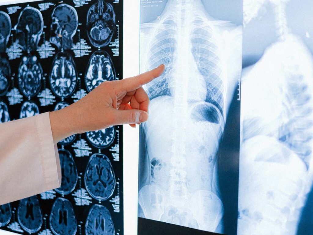 Infarctus intestinal : causes, symptômes et traitement - Eureka Formation