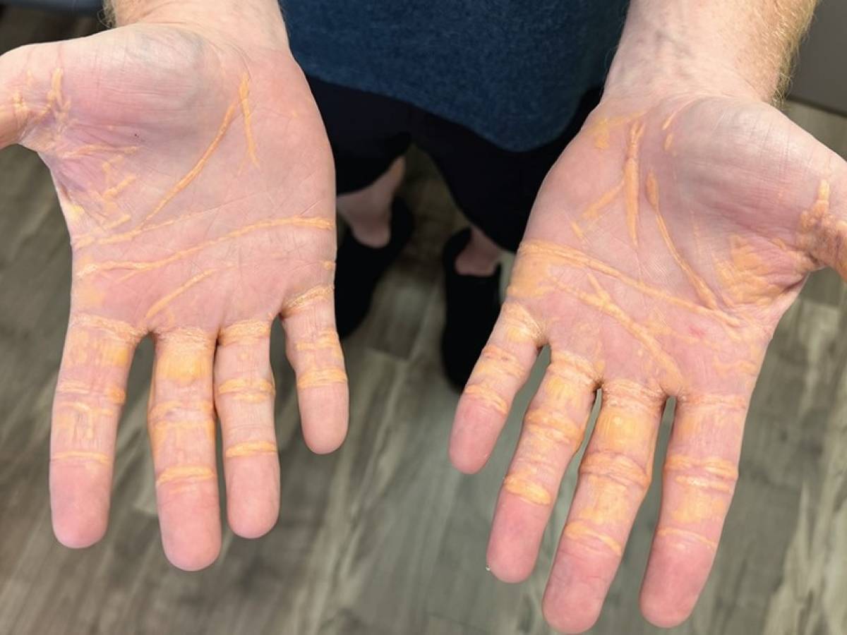 Mangez-vous ces aliments? C'est pourquoi ils deviennent les mains ...